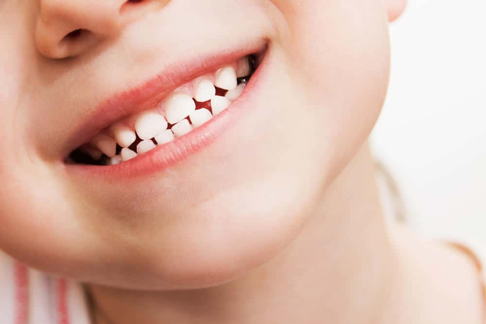Primary Teeth Importance | MySmile Orthodontics 06468